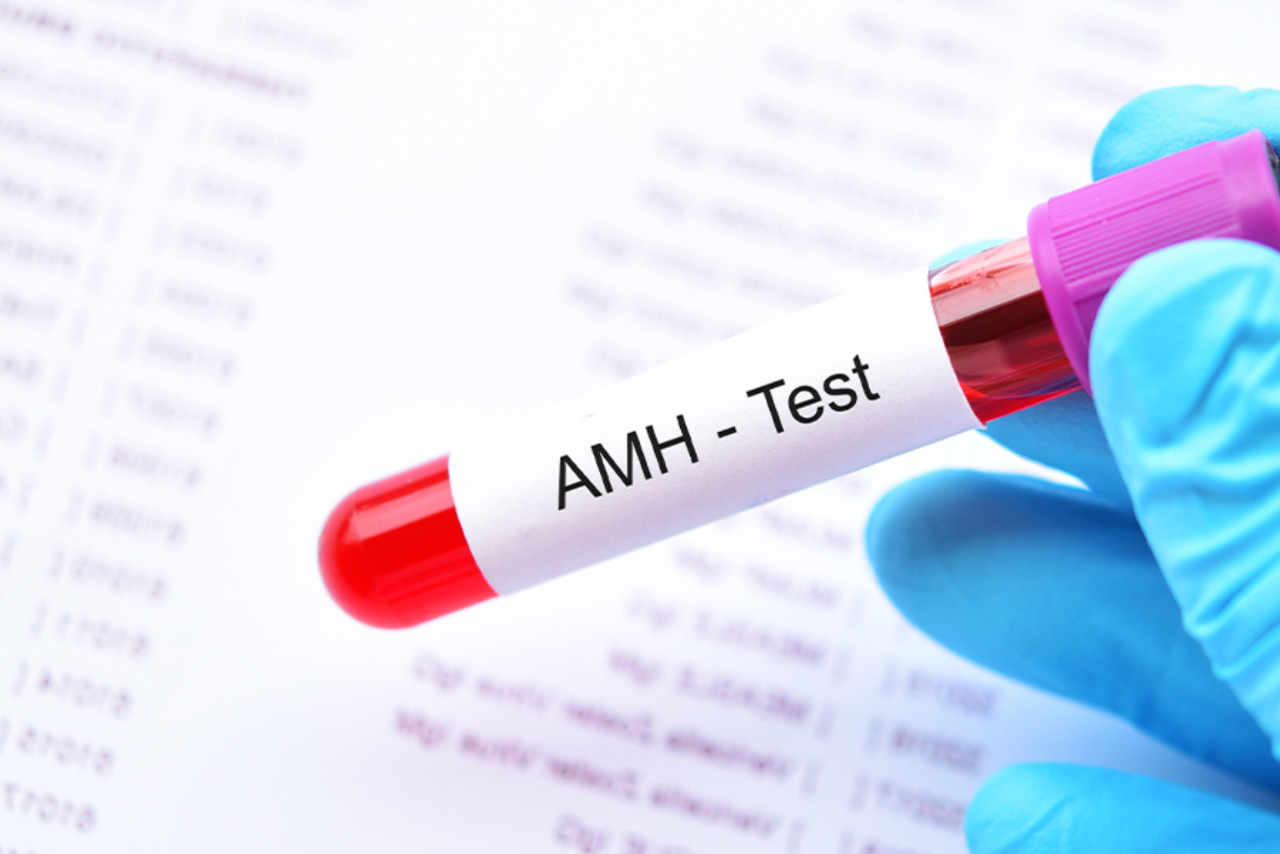AMH Test for Fertility Planning in Dubai - CallMyDoctor - 24x7 Expert ...