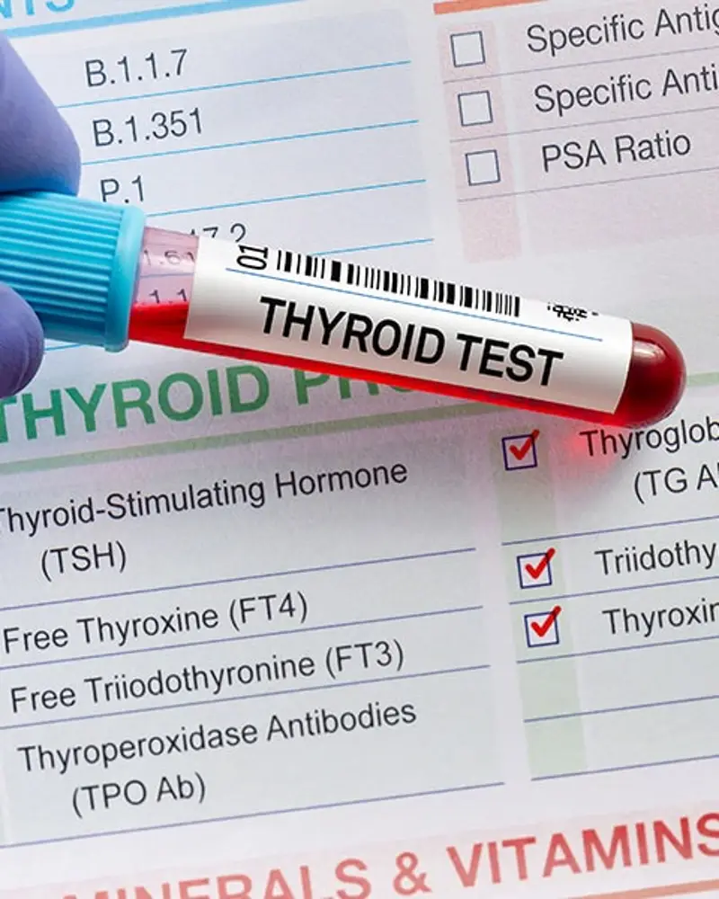 Thyroid Test Dubai | Fast Home Testing | Call My Doctor